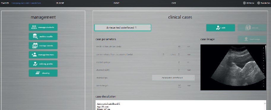 TransferSim™ – Simulator for Embryo Transfer Procedure (TSF) – Accurate